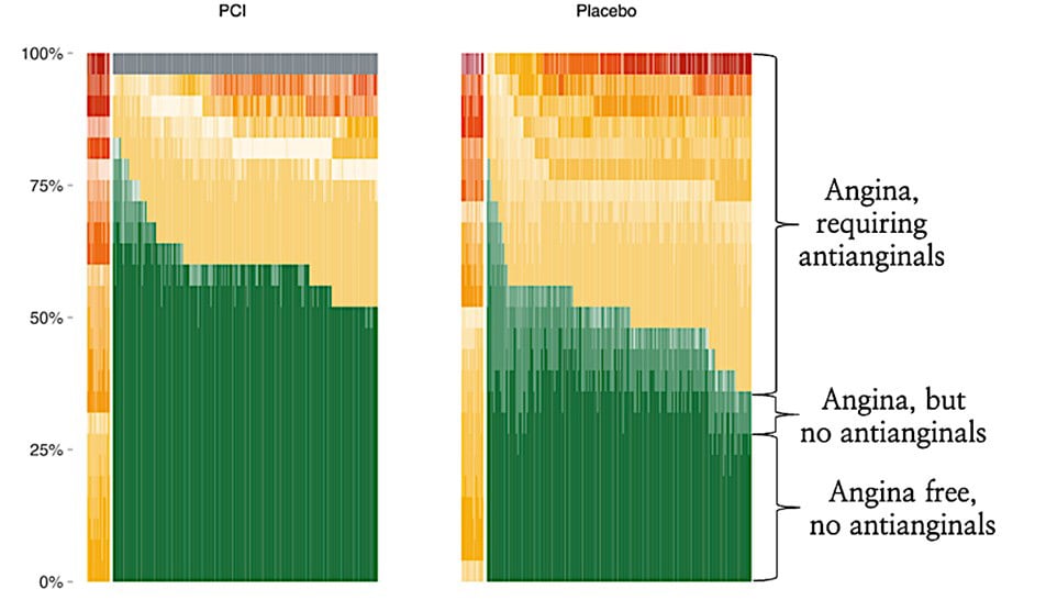 A randomized, placebo-controlled trial of chronic total occlusion PCI ...