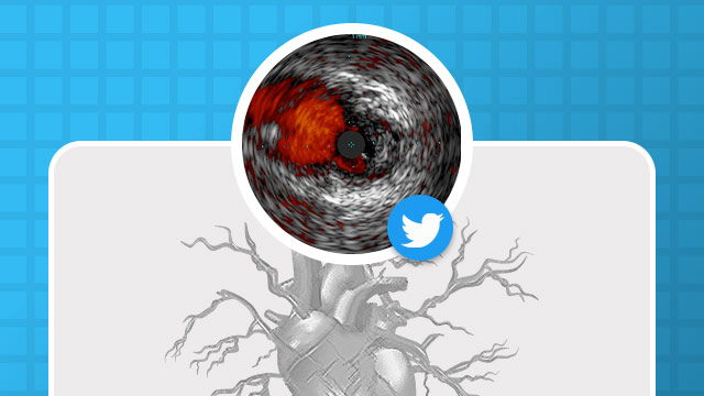 First half of DK-Crush technique for bailout stenting of a true 0,0,1 ...