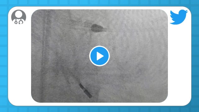 Impella utilization in high-risk percutaneous coronary intervention ...