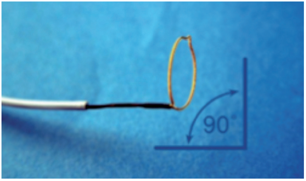 Snare technique in the event of wire loss: GooseNeck
