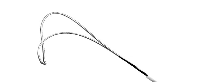 Stent retrieval using the stiff wire technique with snare
