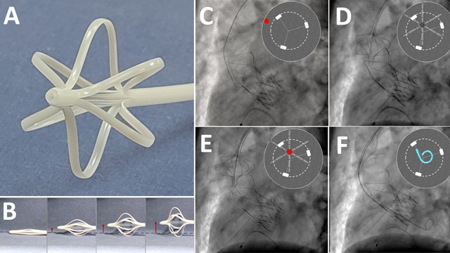 First-in-human experience with EasyCross: a novel catheter for a safe ...
