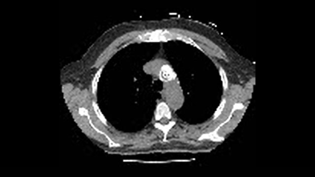 Rorschach test - Image 6