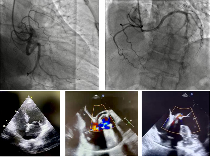 A finding not to be overlooked