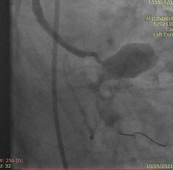 If you hurt veins, they may shed blood