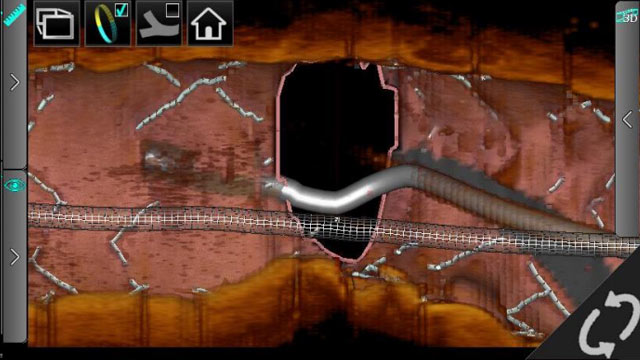 Bifurcation stenting techniques and tools