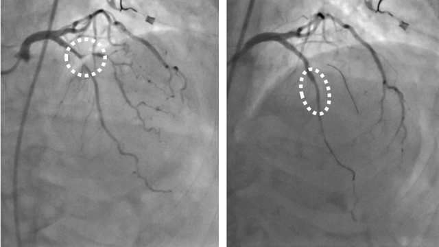 Bifurcations - Which technique, when, why and how?