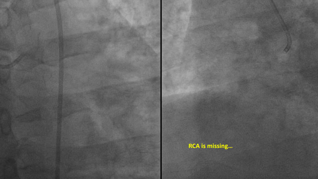 Challenging cases in primary PCI