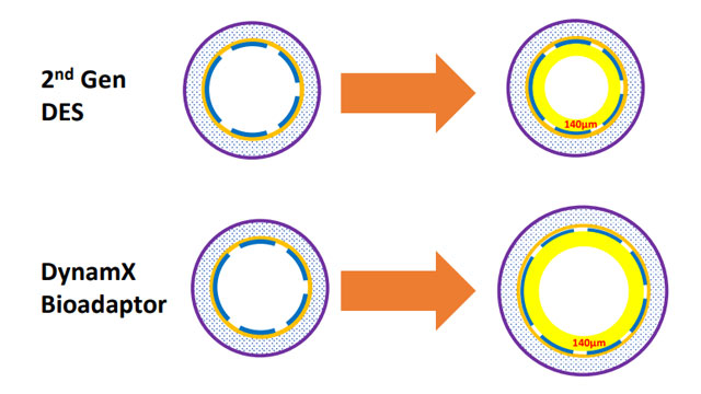 Latest generation DES - What do I need to know?