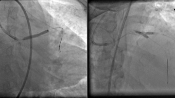 Pandula Athauda Arachchi