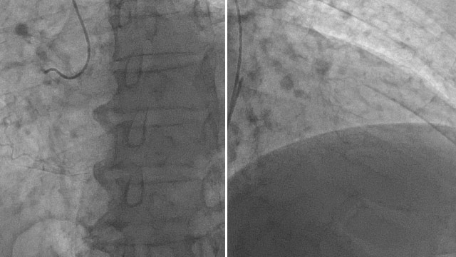 Imaging Day - Case-based echo imaging for the aortic valve
