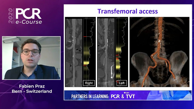 Low risk TAVI trials in the real world: where are we in 2020?