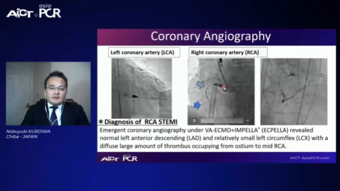 NSTEMI (Non-ST-segment elevation myocardial infarction)
