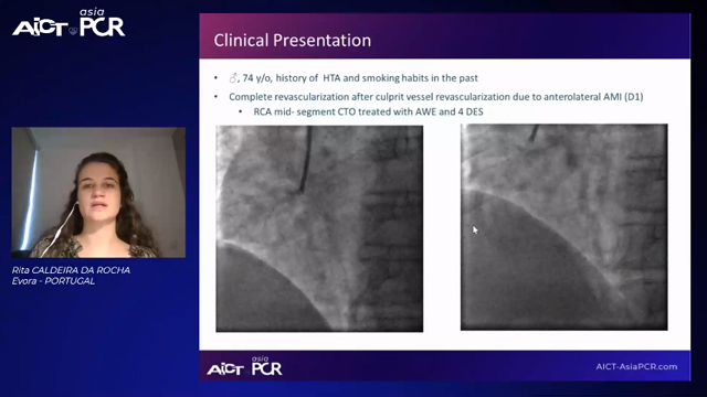 Cases on complications: stable CAD, stents & scaffolds