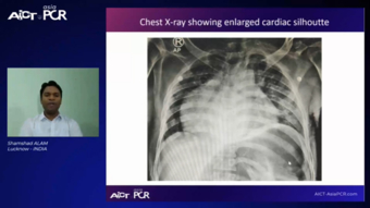 Other peripheral interventions