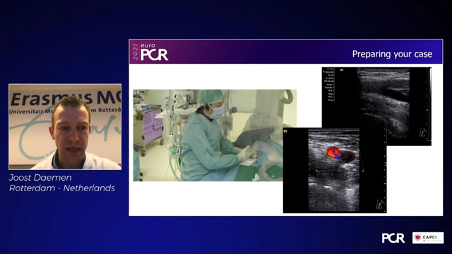 Current status of renal denervation techniques for the treatment of ...