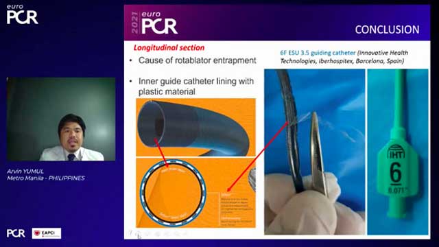 Complications in complex rotational atherectomy