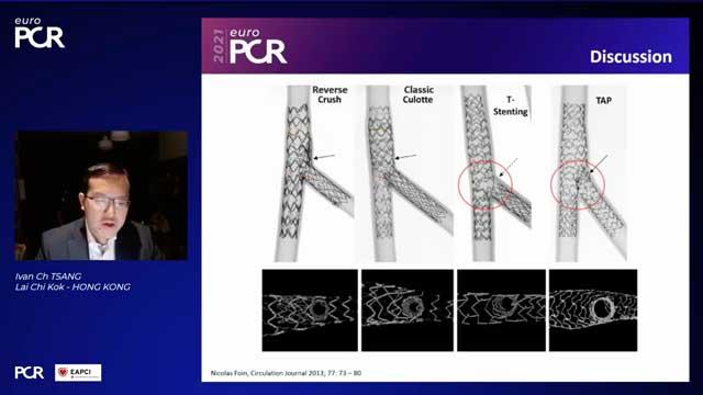 Tips & tricks in bifurcation stenting - Part 1