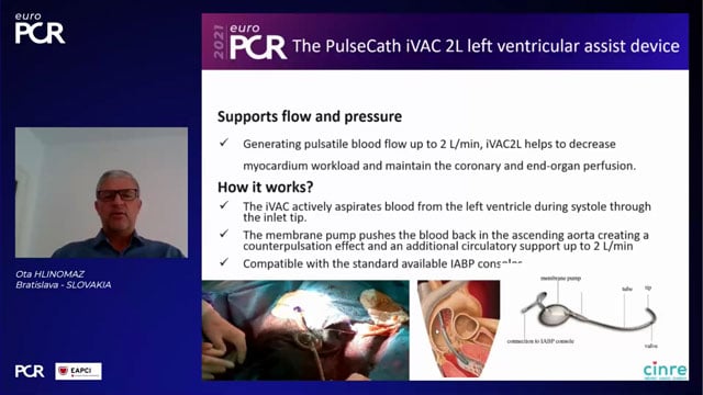 Emergent PCI in Cardiogenic shock