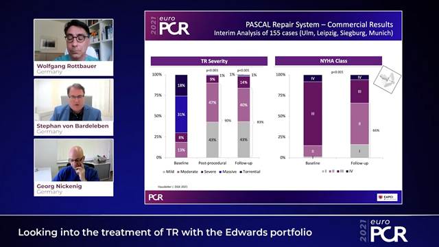 Looking into the treatment of TR with the Edwards portfolio