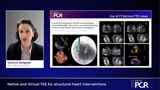 Native and virtual TEE for structural heart interventions