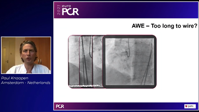 New perspectives in CTO PCI, a case-based approach