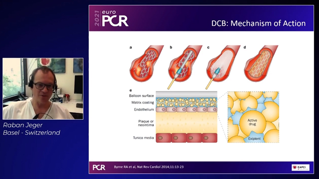 Paclitaxel and sirolimus coated balloons: create evidence before claims