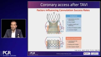 TAVI (Transcatheter aortic valve implantation)
