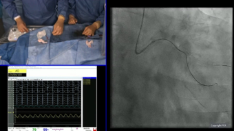 Francesca Sanguineti