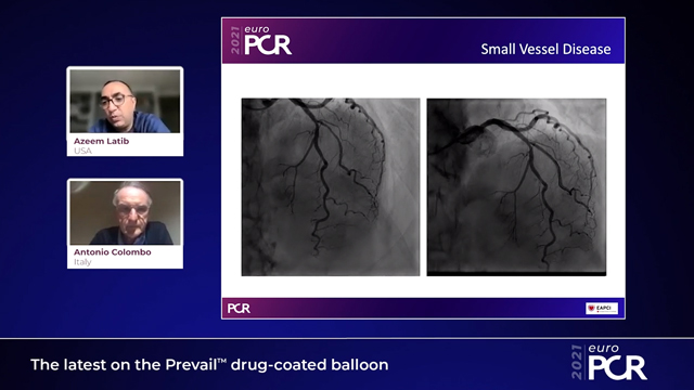 The latest on the prevail drug-coated balloon