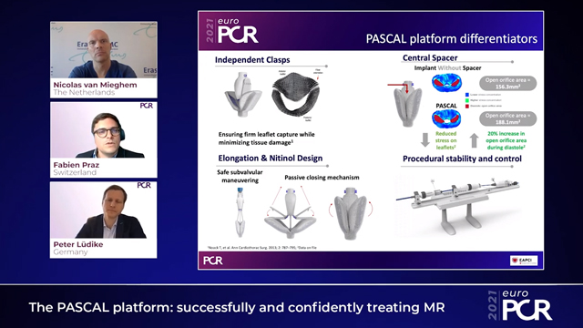 The PASCAL platform: successfully and confidently treating MR