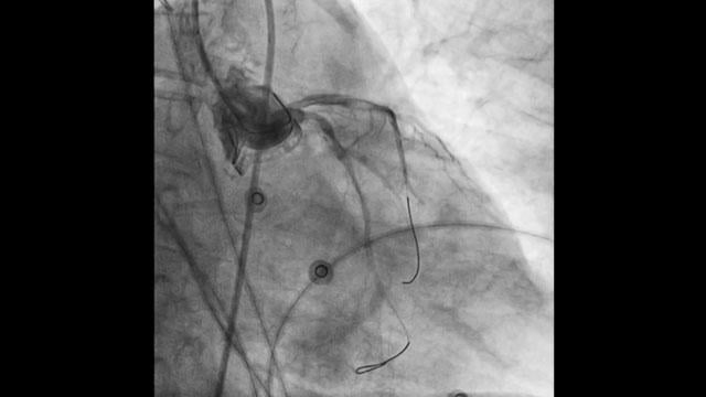 Challenging and complication cases