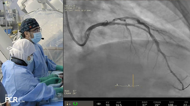 Complex left main PCI - Session with LIVE case