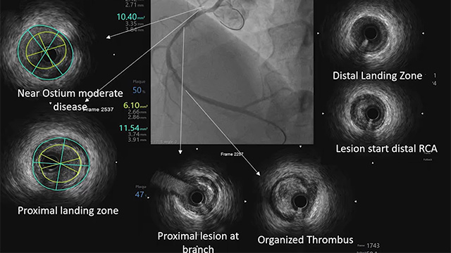 Dealing with complex and high-risk interventions