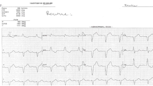 How to achieve safe early discharge