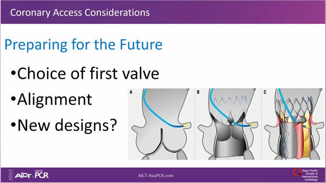 Lifetime management of patients with aortic stenosis