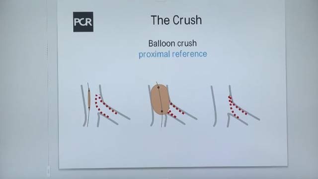 Pearls and pitfalls of DK Crush stenting