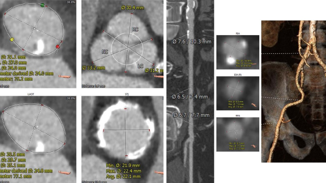 Rapid-fire clinical cases: Session 1