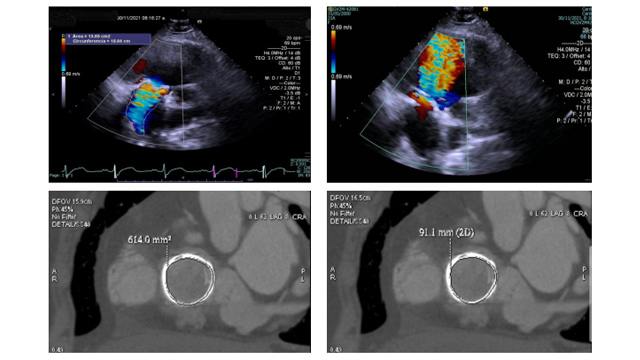 Rapid-fire clinical cases: Session 6