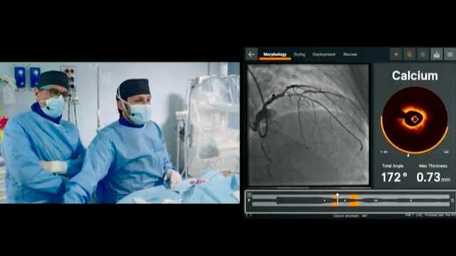 Stent failure: how to treat, how to prevent