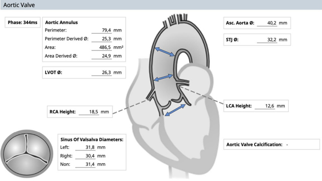 TAVI is a mature procedure: implications for lifelong management of ...