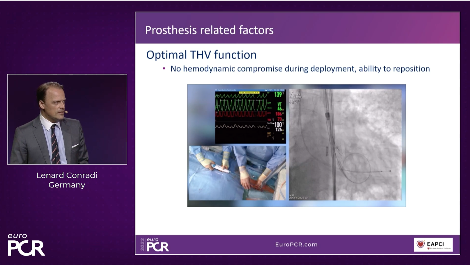 The impact of the first transcatheter heart valve on the lifetime ...