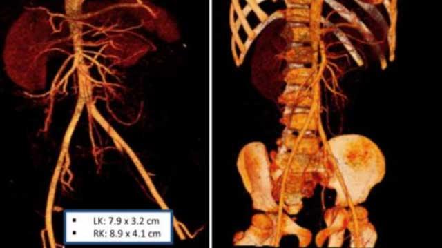 Coronary clinical cases - session 3