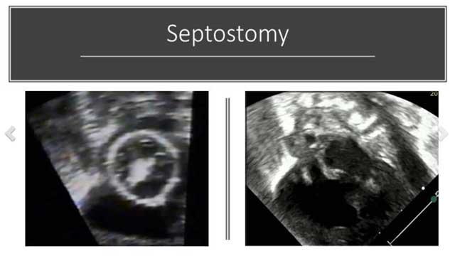 How should I treat a blue baby - A patient's journey