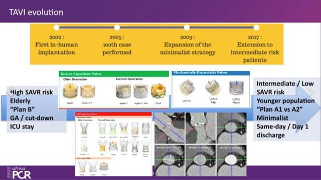 Matching patient to TAVI prosthesis - Is there a better way?