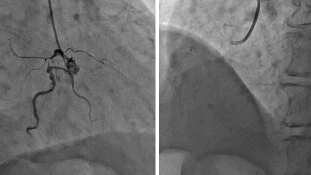 Learning - A mission impossible: smorgasboard of high bleeding risk issues