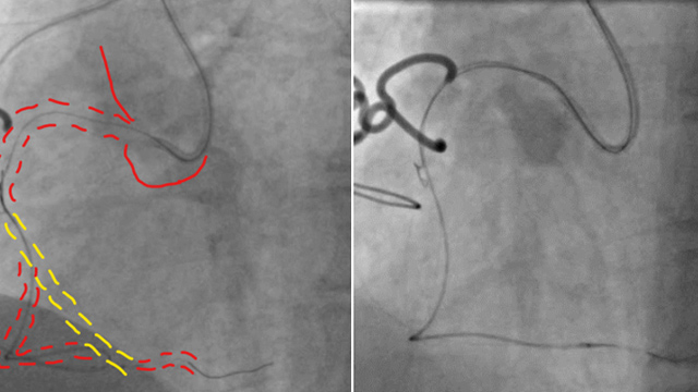 Navigating complex CTO scenarios