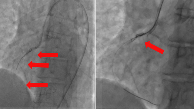 Top cases of AICT-AsiaPCR 2023