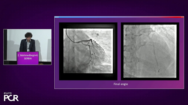Close call! Complex ACS cases
