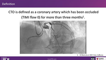 CTO: more than just a procedure